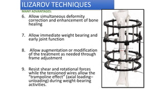 ILIZAROV RING FIXATOR.pptx