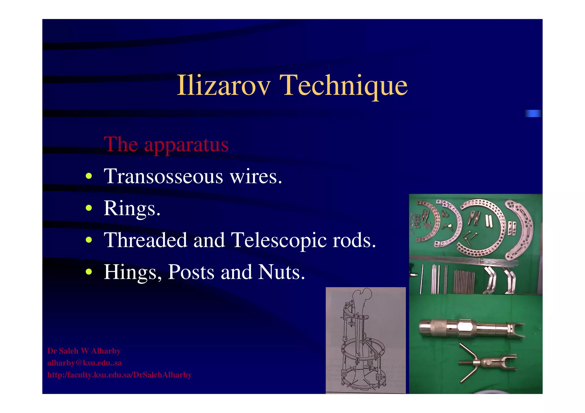 Ilizarov technique | PDF
