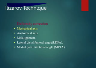 ilizarov technique.pptx
