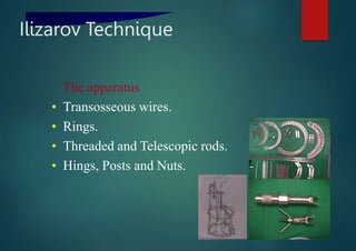 ilizarov technique.pptx