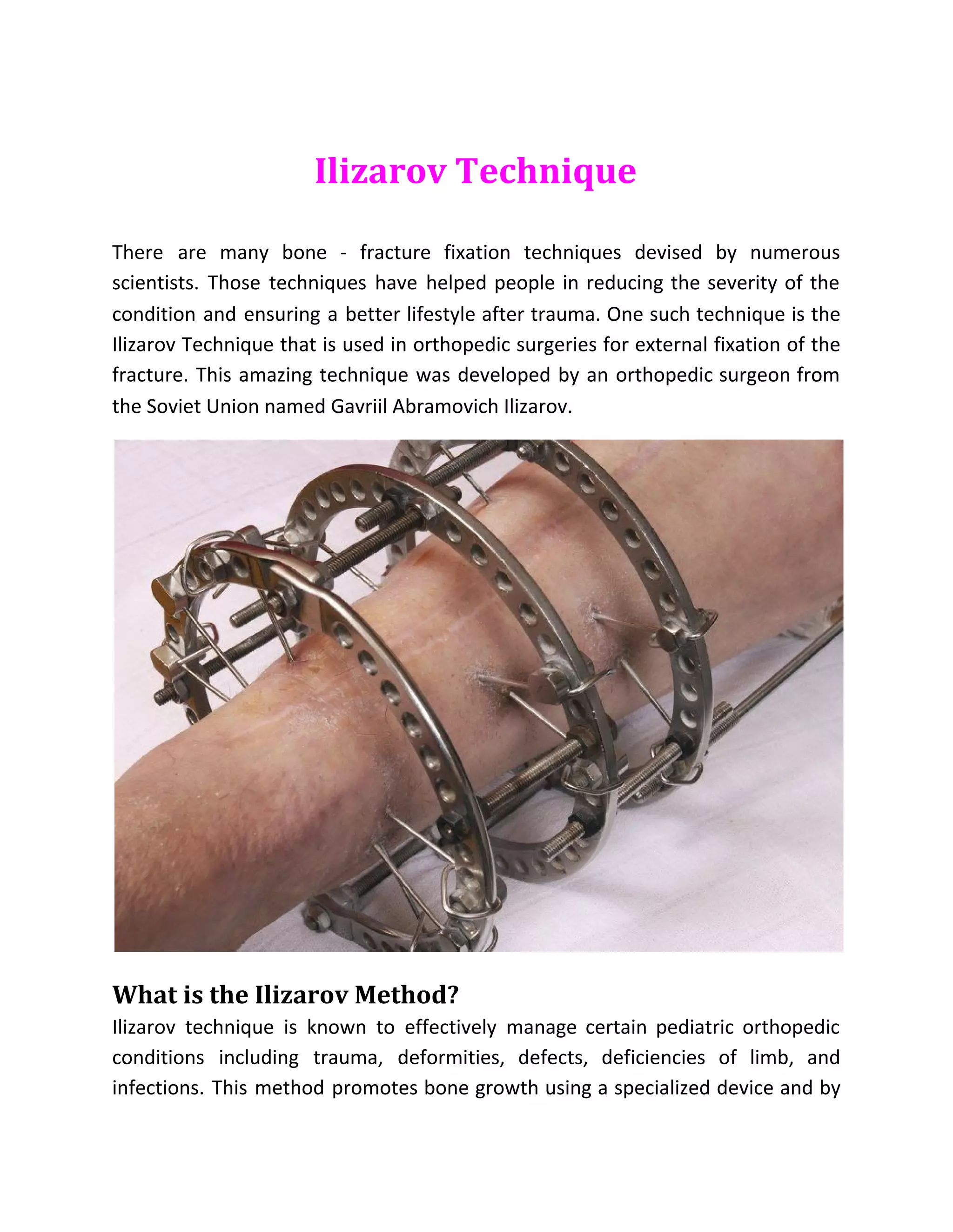 Ilizarov technique - what you need to know | PDF