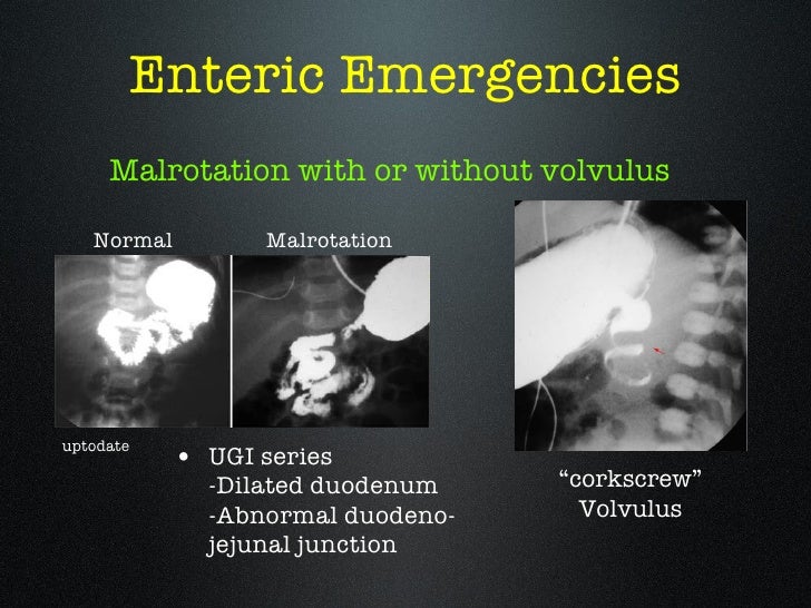 Ill appearing neonates