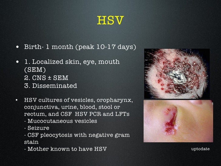 Ill appearing neonates