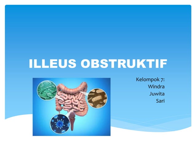 ILEUS OBSTRUKTIF | PPT