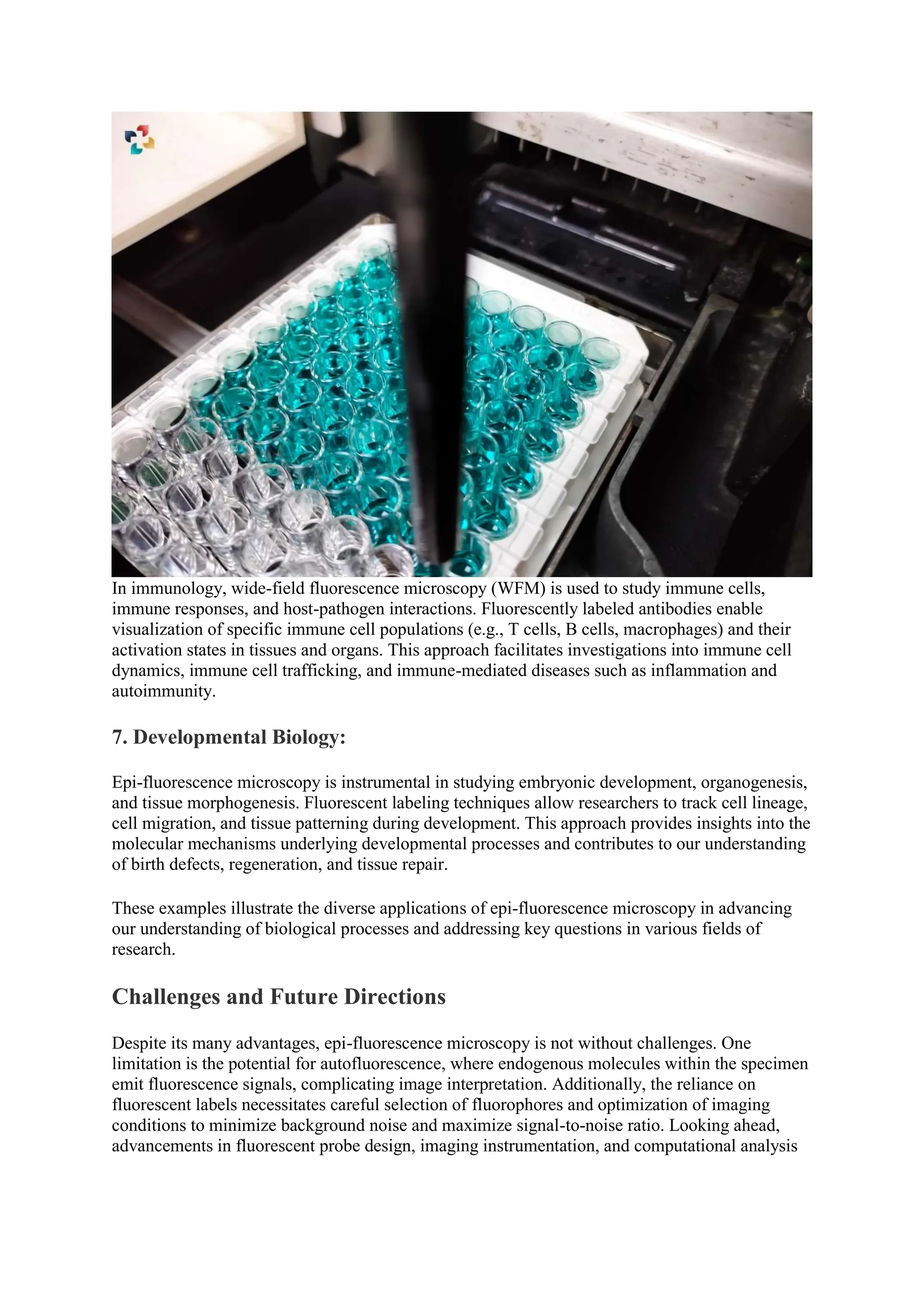 Epi-Fluorescence Microscopy: Explore Its Amazing Powers and Uses | The ...