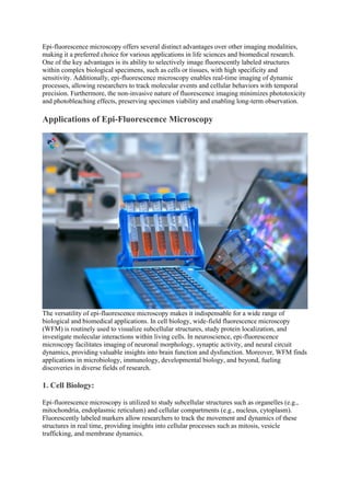Epi-Fluorescence Microscopy: Explore Its Amazing Powers and Uses | The ...
