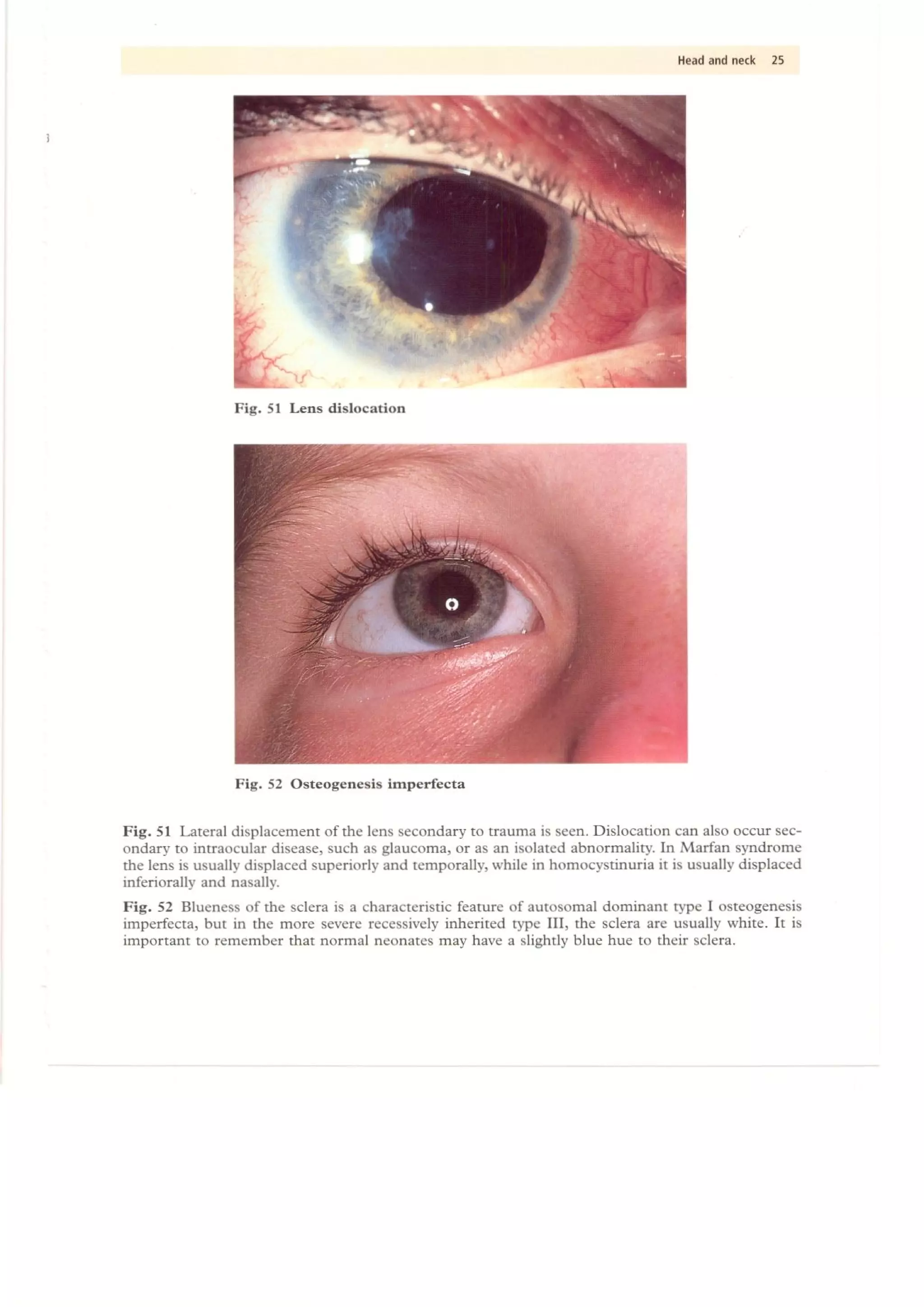 Illustrated signs in clinical pediatrics | PDF