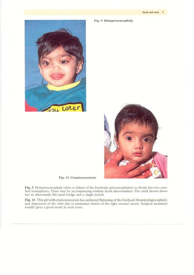 Illustrated signs in clinical pediatrics | PDF