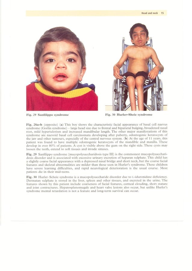 Illustrated signs in clinical pediatrics | PDF