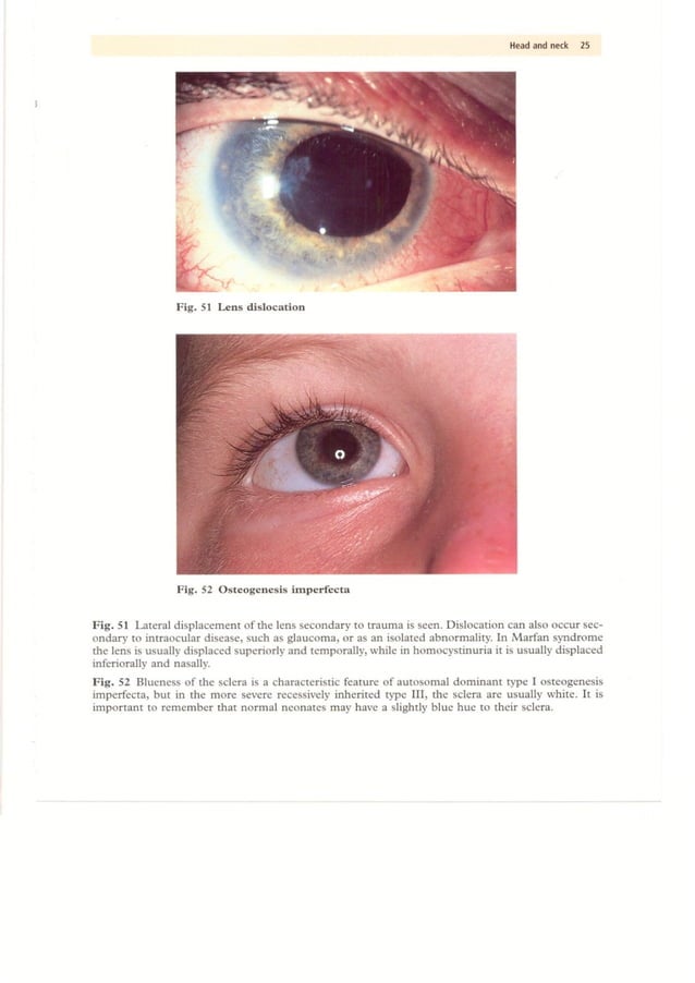 Illustrated signs in clinical pediatrics | PDF