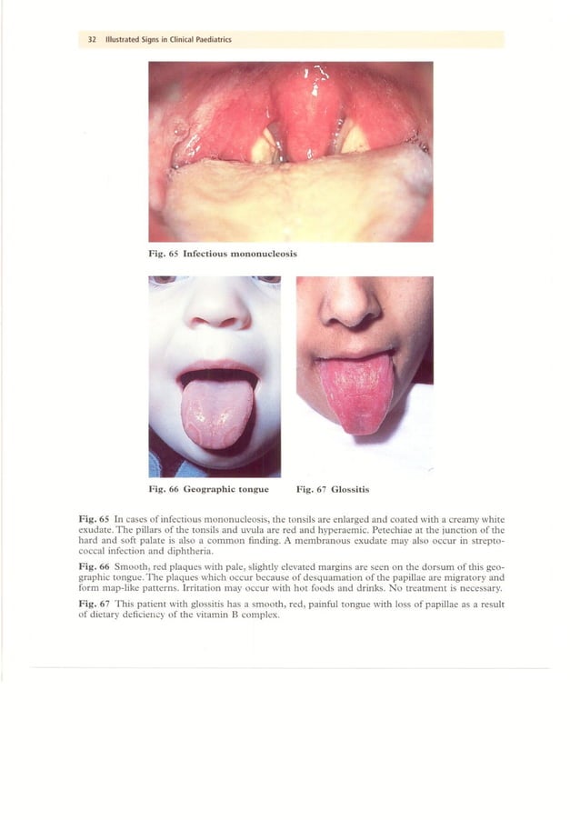 Illustrated signs in clinical pediatrics | PDF