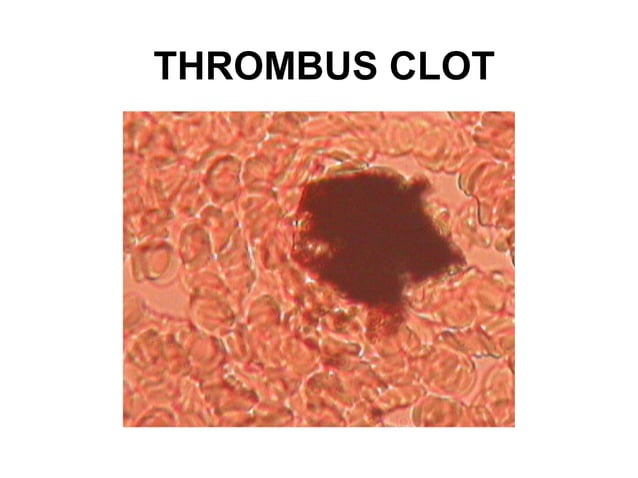 Ilmu dasar life blood analysis (lba) | PPT