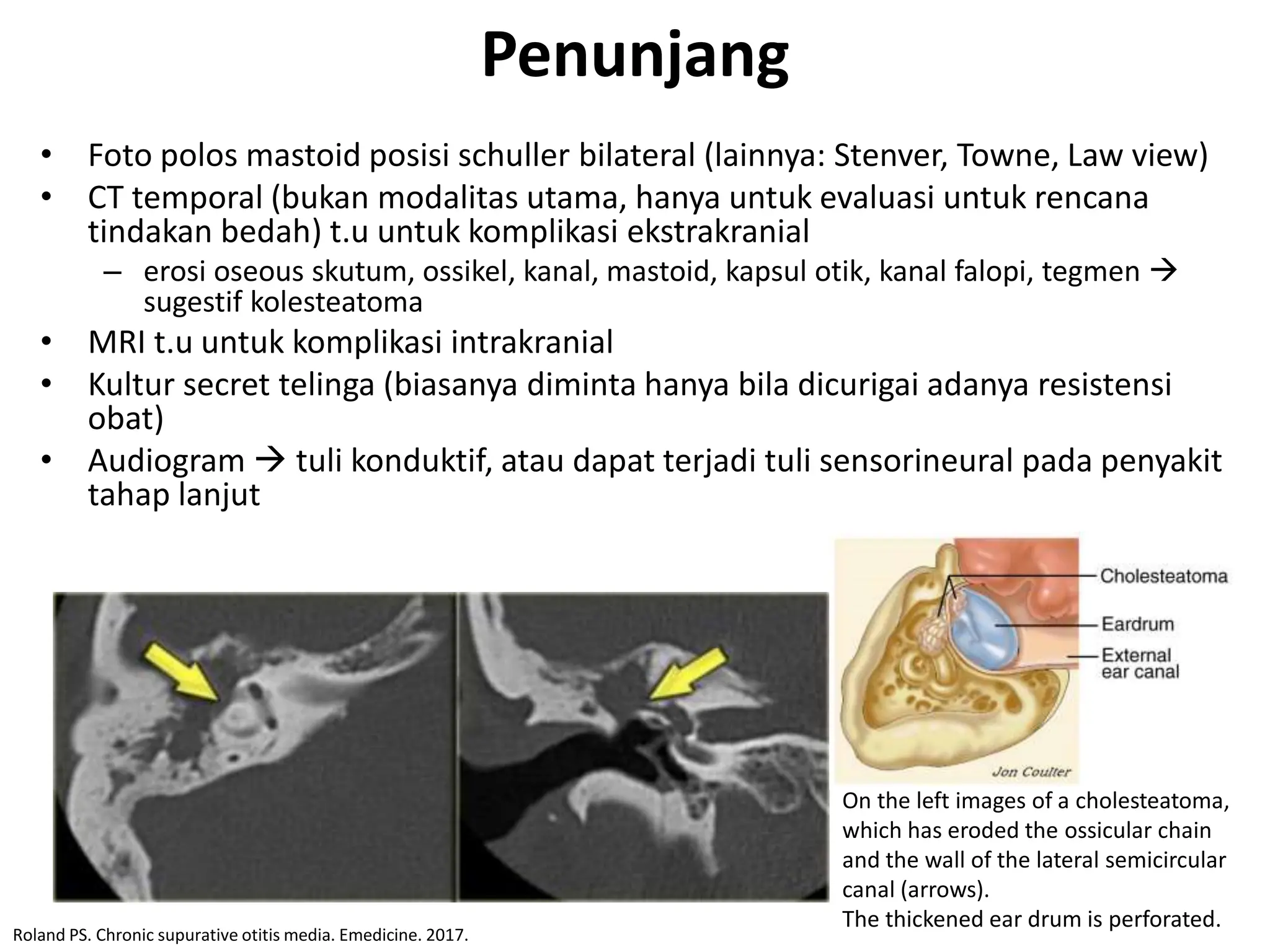BLOK Ilmu THT-KL TERBARU LENGKAP NEW.pdf