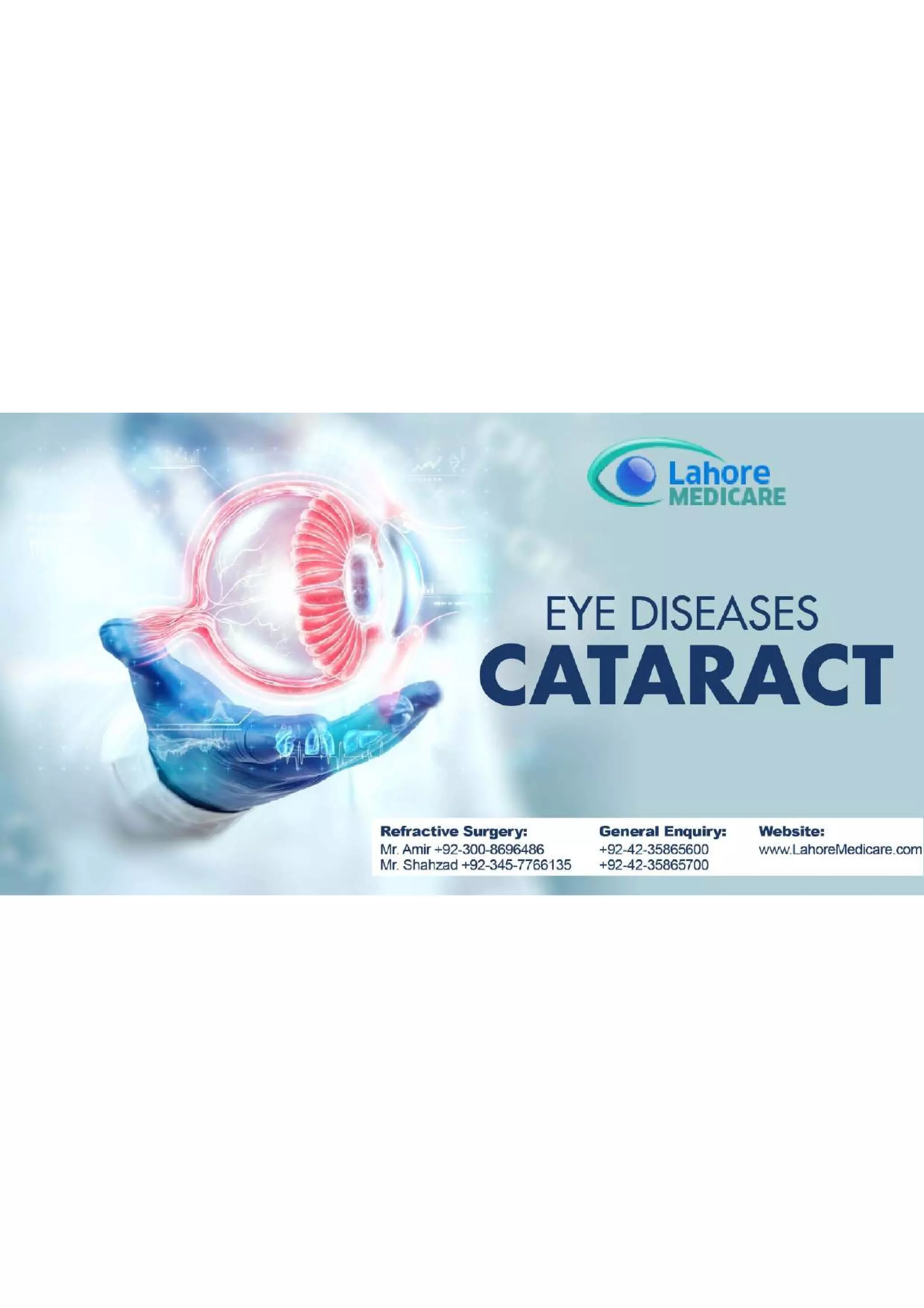 Eye Diseases Cataract | PDF