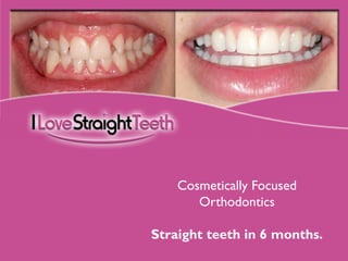 Guide to straight teeth in 6 months | PDF