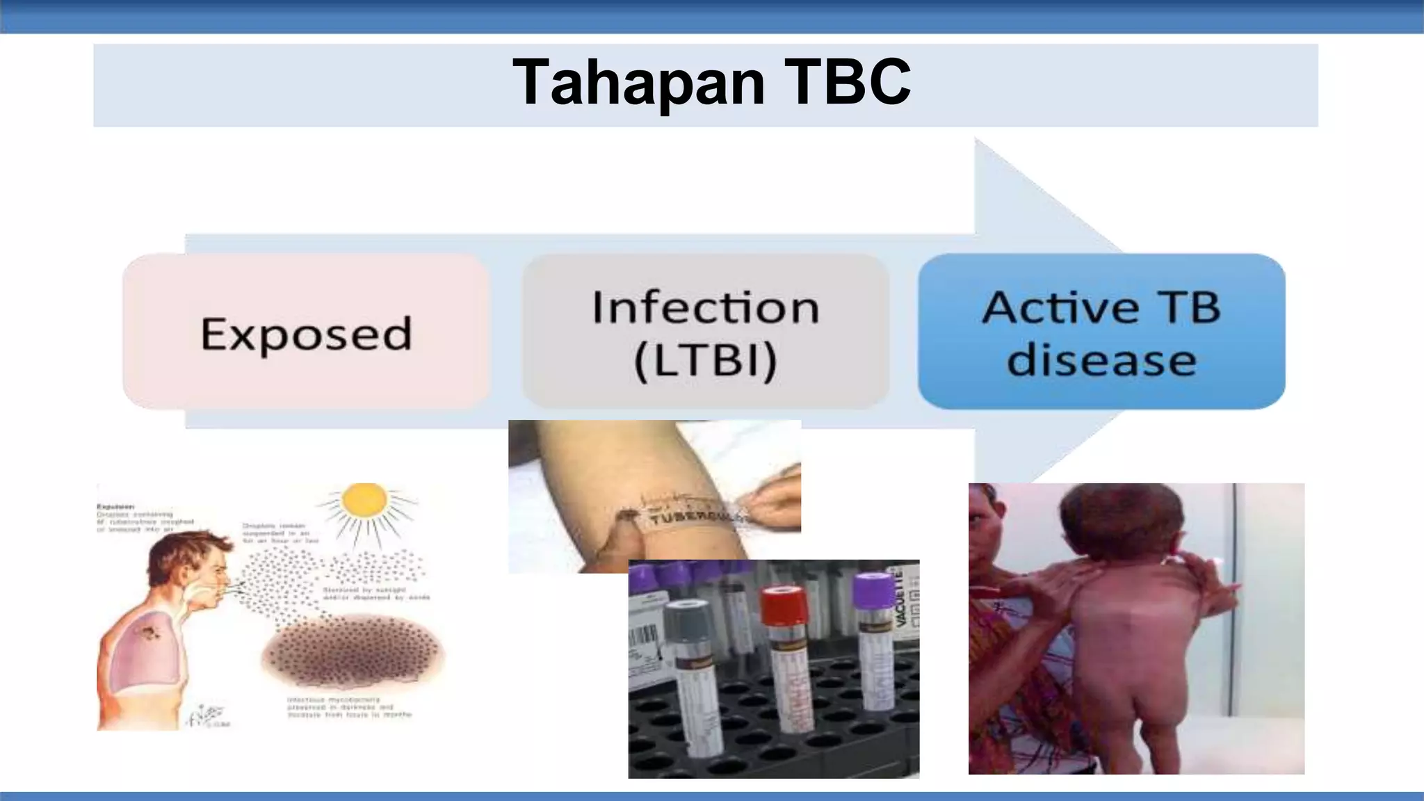 ILTB DAN TPT TBC.pptx