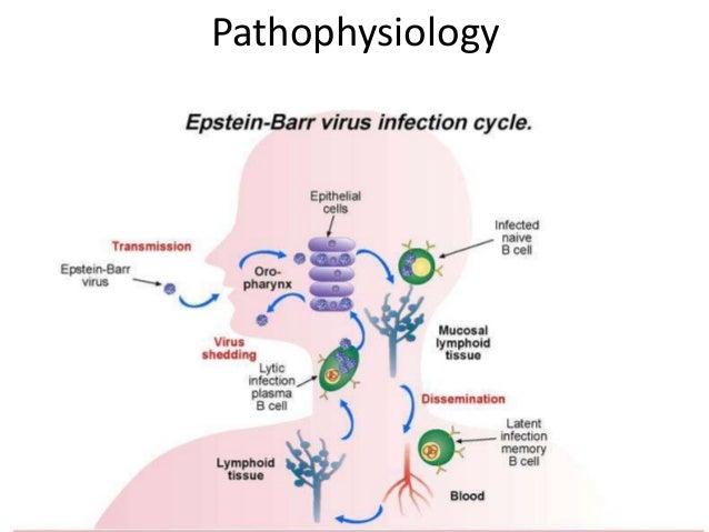 infectious mononucleosis