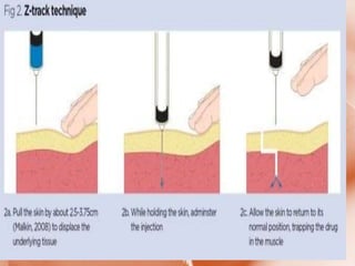 im injection presentation slide ........ | PPT