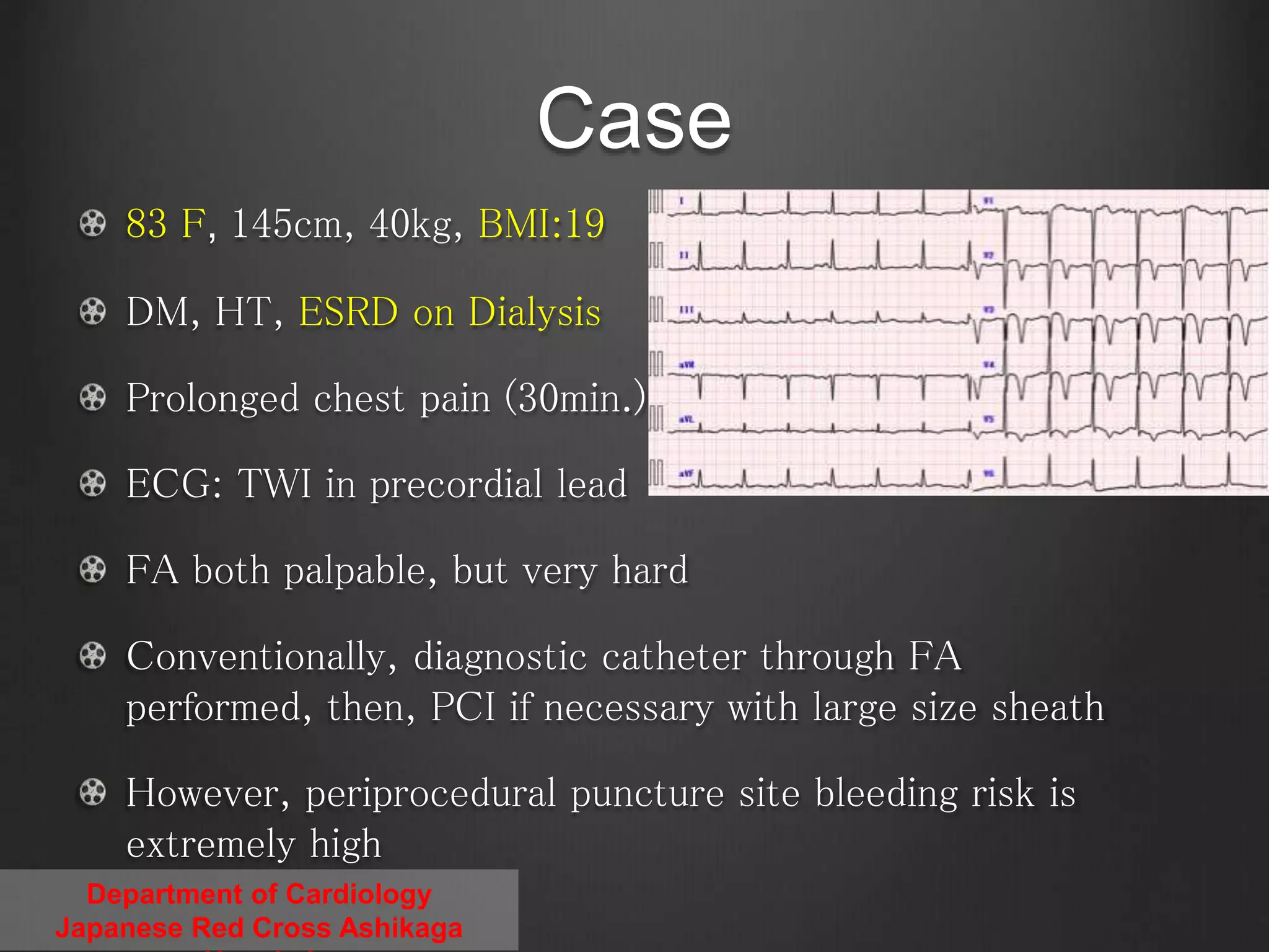 PCI & AimRadial 2018 | A Trans-Radial Approach of Cardiac ...
