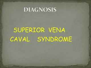 CXR: Superior vena caval syndrome | PPT