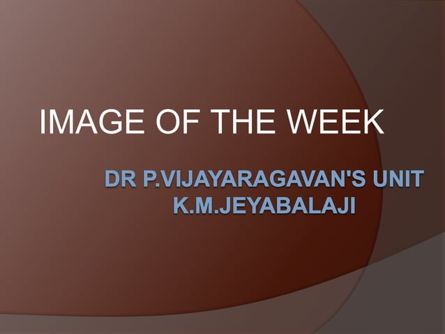 X RAY EGG SHELL CALCIFICTION | PPT