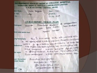 X RAY EGG SHELL CALCIFICTION | PPT