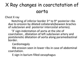 CXR: Coarctation of Aorta | PPT