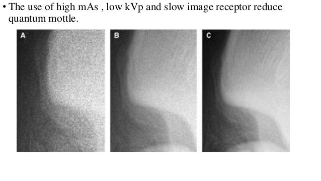 Image characteristics of x ray film