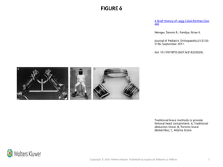 Perthes disease overview Lippincott.pptx