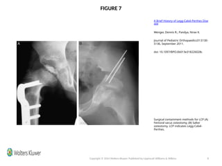 Perthes disease overview Lippincott.pptx
