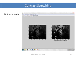 Image enhancement techniques | PPTX