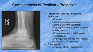 Image evaluation lateral ankle mattingly | PPTX