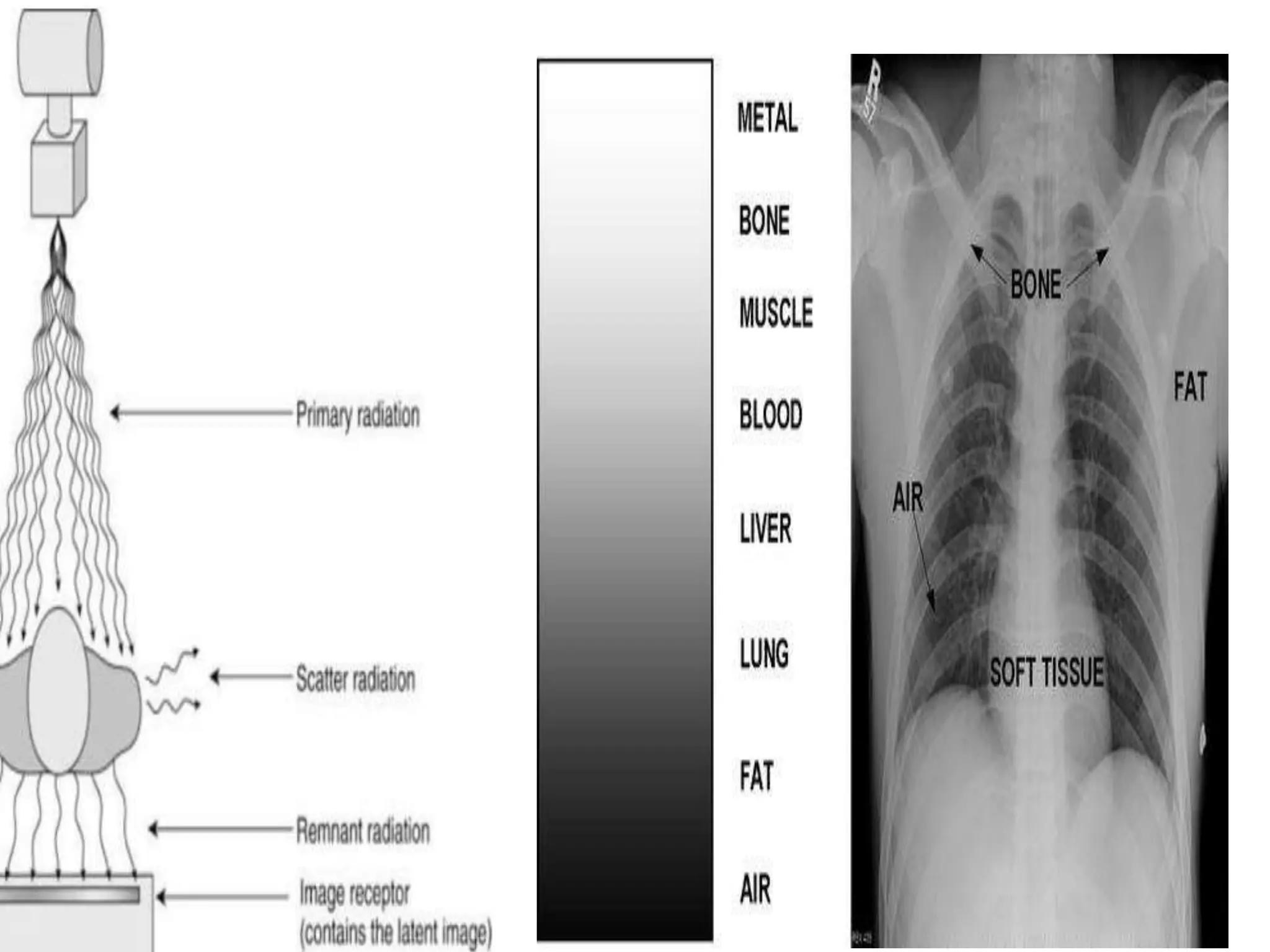 Image formation of Radiology from Radiation | PPTX