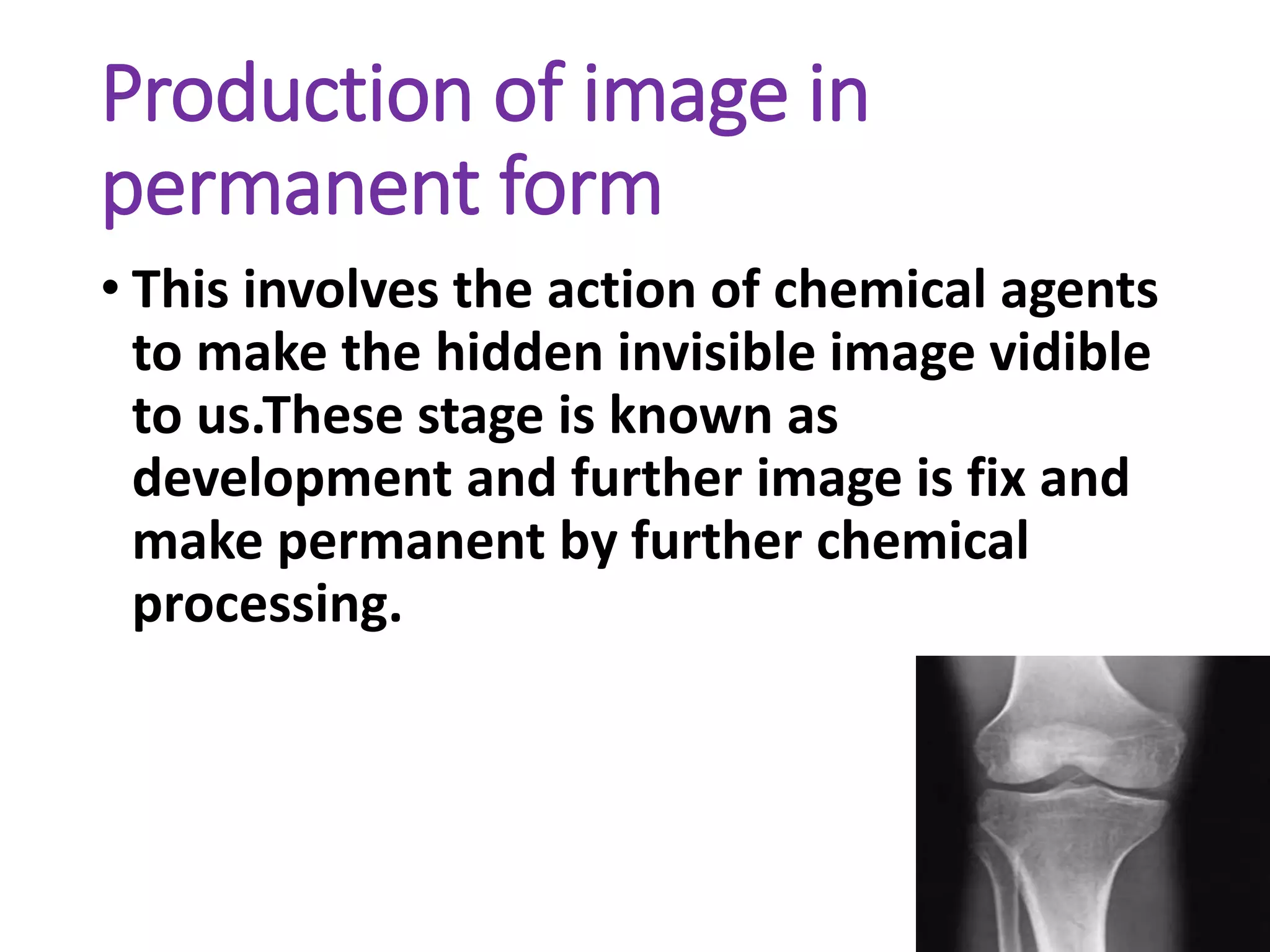 Image formation of Radiology from Radiation | PPTX