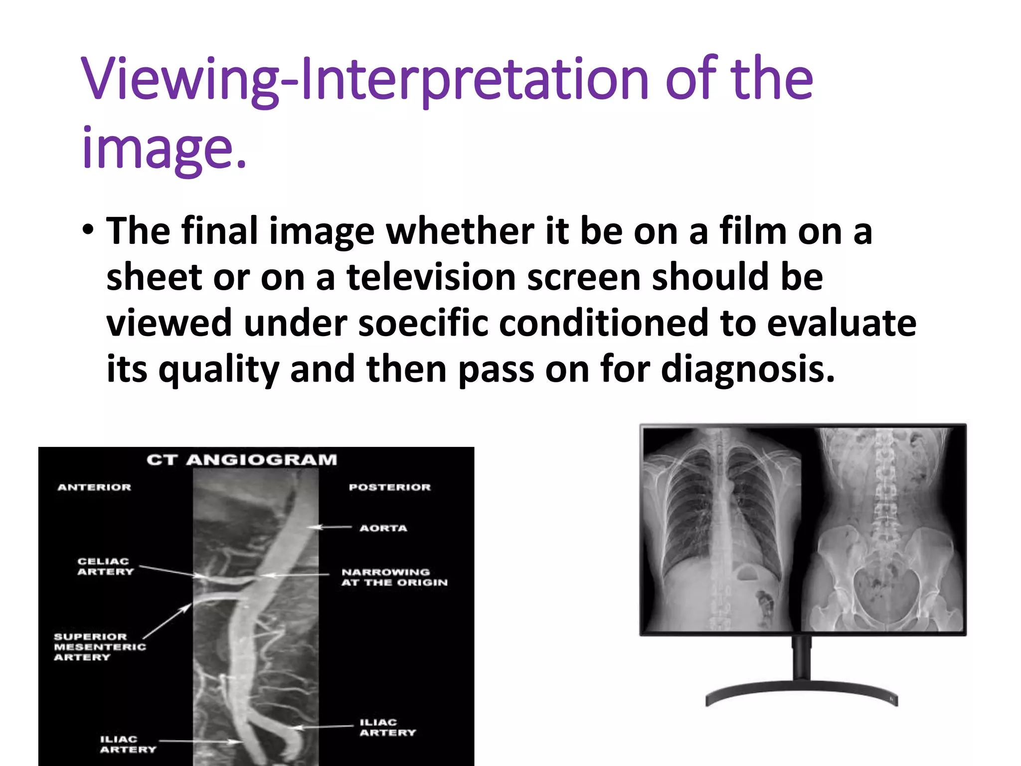 Image formation of Radiology from Radiation | PPTX