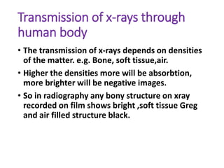 Image formation of Radiology from Radiation | PPTX