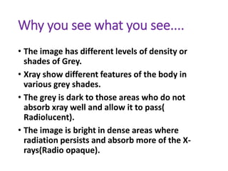 Image formation of Radiology from Radiation | PPTX
