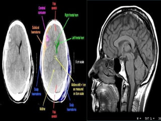 Imagefusfinalppt 140413102757-phpapp02 | PPT