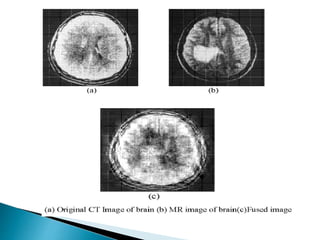 Imagefusfinalppt 140413102757-phpapp02 | PPT