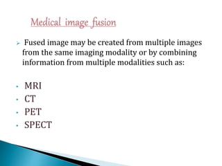 Imagefusfinalppt 140413102757-phpapp02 | PPT
