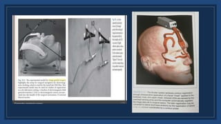 Image guided surgery | PPTX