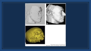 Image guided surgery | PPTX