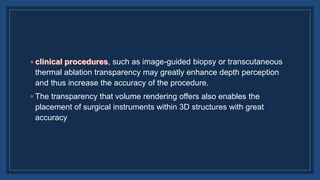 Image guided surgery | PPTX