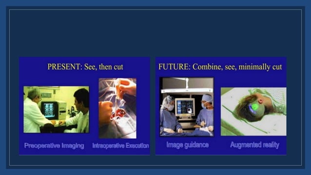 Image guided surgery | PPTX