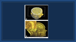 Image guided surgery | PPTX