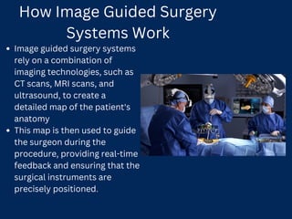 IMAGE GUIDED SURGERY SYSTEM .pdf