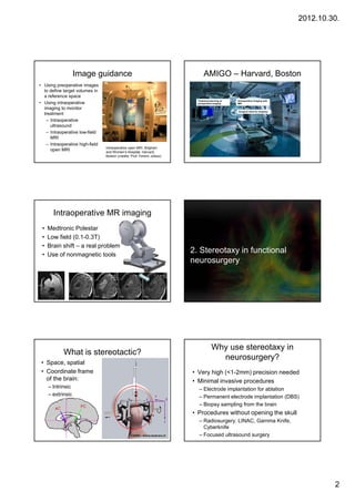 Week 4. Image guided therapies. | PDF | Brain and Nervous System Disorders | Diseases and Conditions