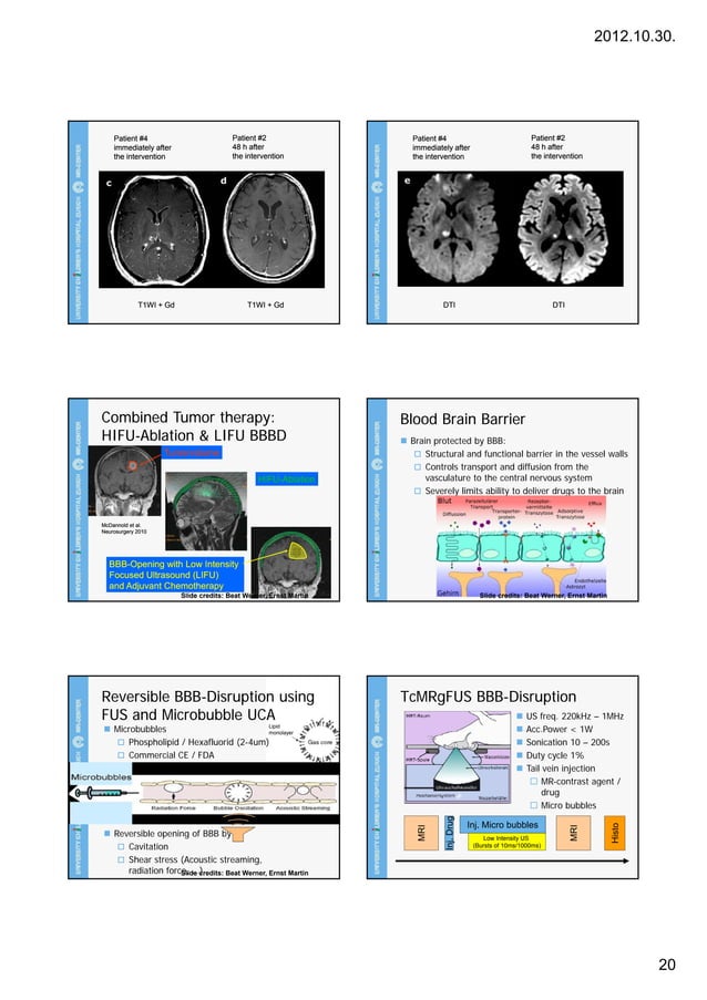 Week 4. Image guided therapies. | PDF | Brain and Nervous System Disorders | Diseases and Conditions