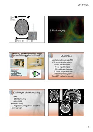 Week 4. Image guided therapies. | PDF | Brain and Nervous System ...
