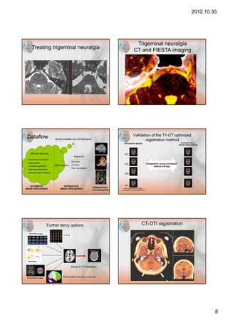 Week 4. Image guided therapies. | PDF | Brain and Nervous System Disorders | Diseases and Conditions